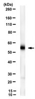 Anti-CD368/CLEC4D Antibody, clone WEN42 | MABS1931-25UG